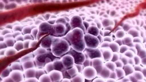 Umělou DNA proti rakovině - 28. října 2013 - Události | Česká televize